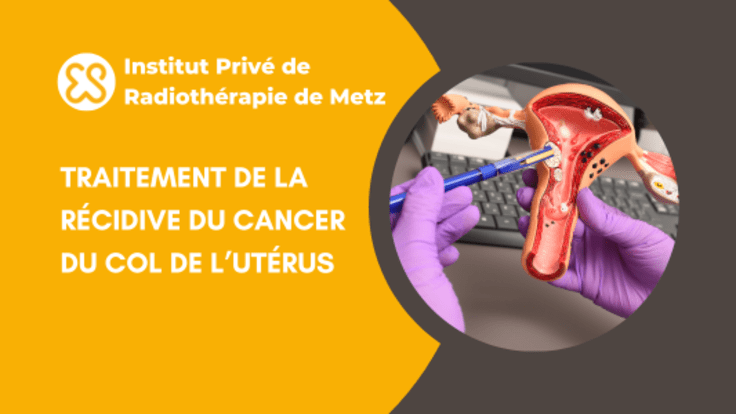 Récidive cancer col utérus : traitements tumeurs du col utérin
